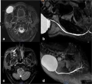 בדיקות חדשות בעזרת סורק ה-MRI - MRI המדריך המלא